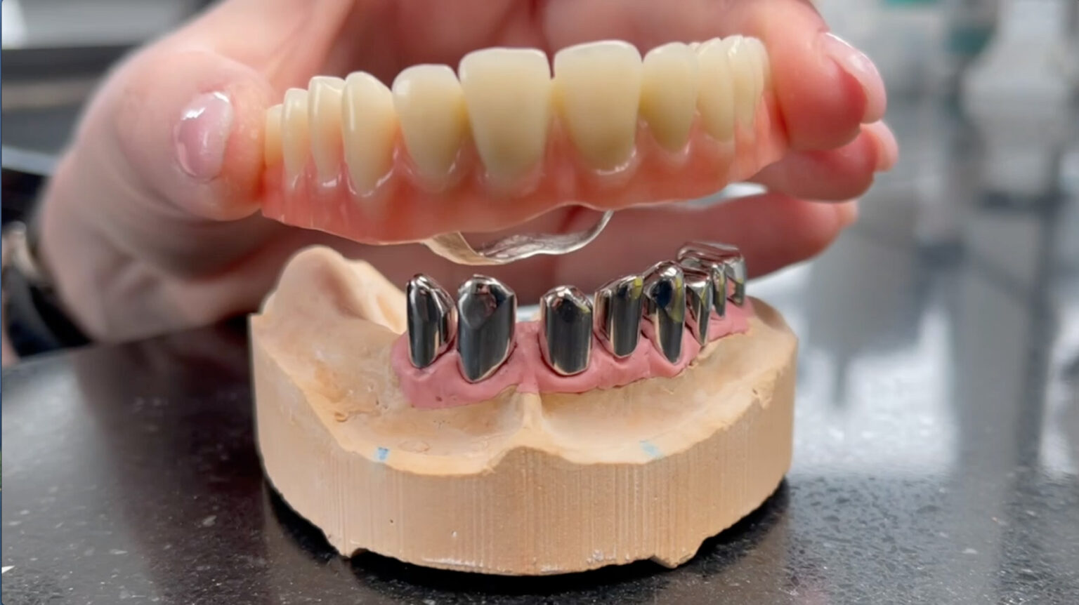 Herausnehmbarer Zahnersatz - ZSC Stuttgart